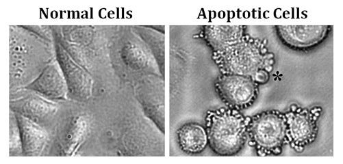 Difference between Apoptosis and Necrosis | EasyBiologyClass
