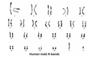 Chromosome Banding Techniques | EasyBiologyClass