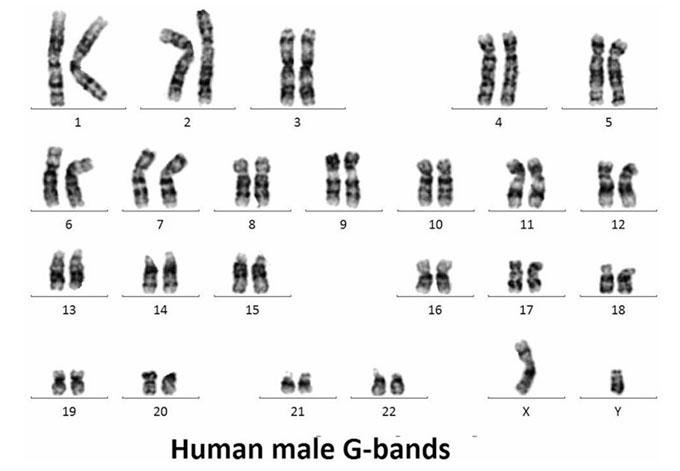 Chromosome Banding Techniques | EasyBiologyClass